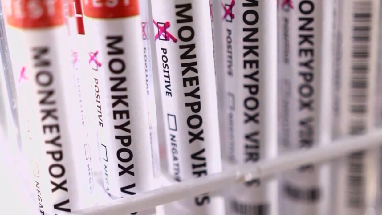 San Francisco to receive 8,000 more doses of monkeypox vaccine - CBS ...