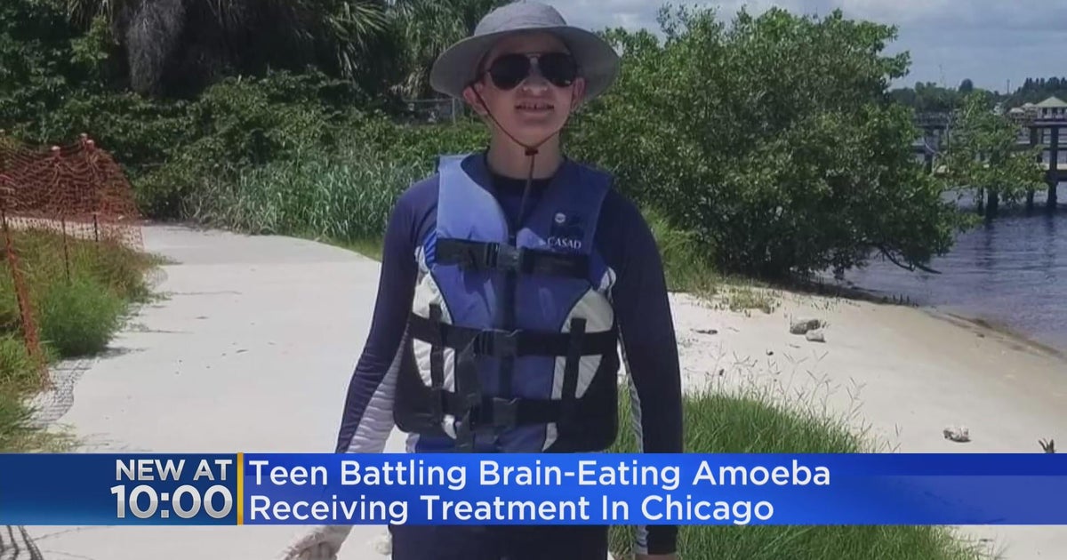 Florida teen suffering from brain-eating amoeba begins treatment in ...