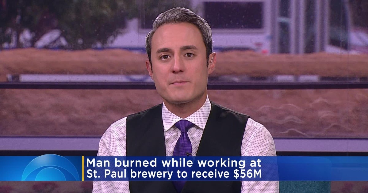 Man burned while working at St. Paul brewery gets $56M - CBS Minnesota