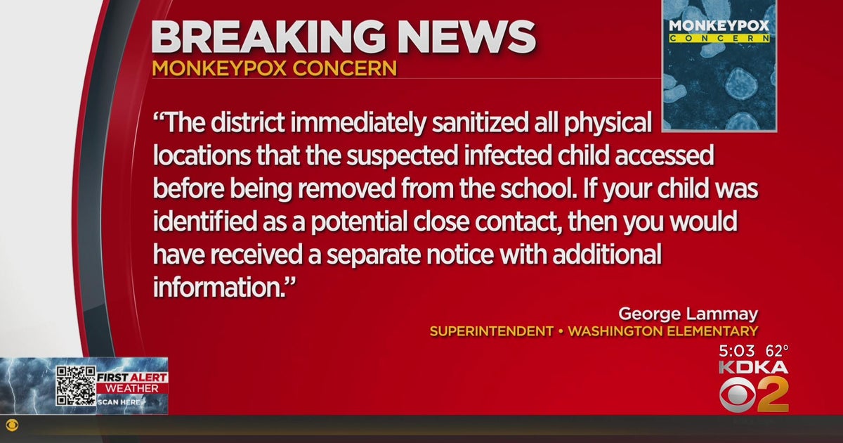 Washington SD awaiting results in suspected monkeypox case - CBS Pittsburgh