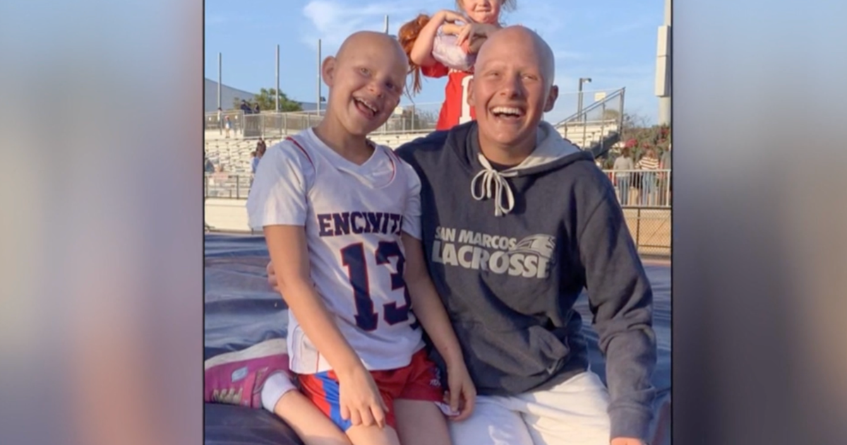 Two girls with alopecia taught each other to be comfortable being ...