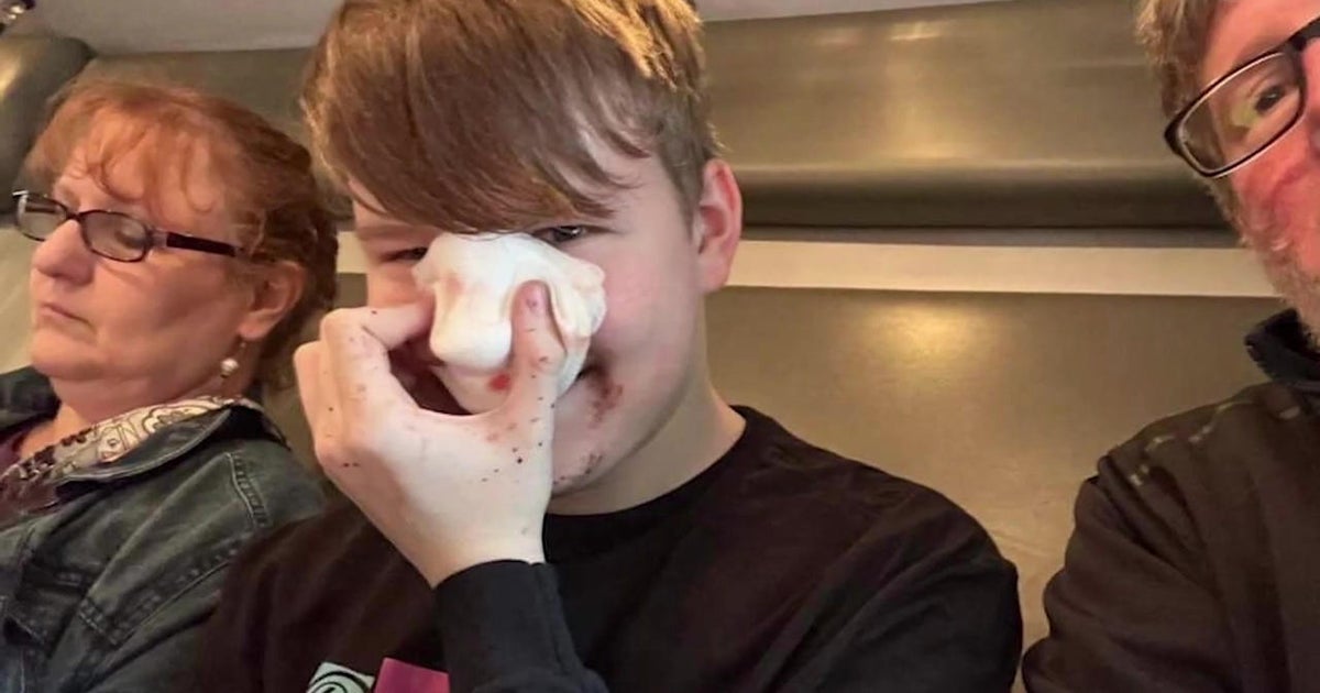 Young Tourist From Tennessee Assaulted Near Central Park New Yorkers