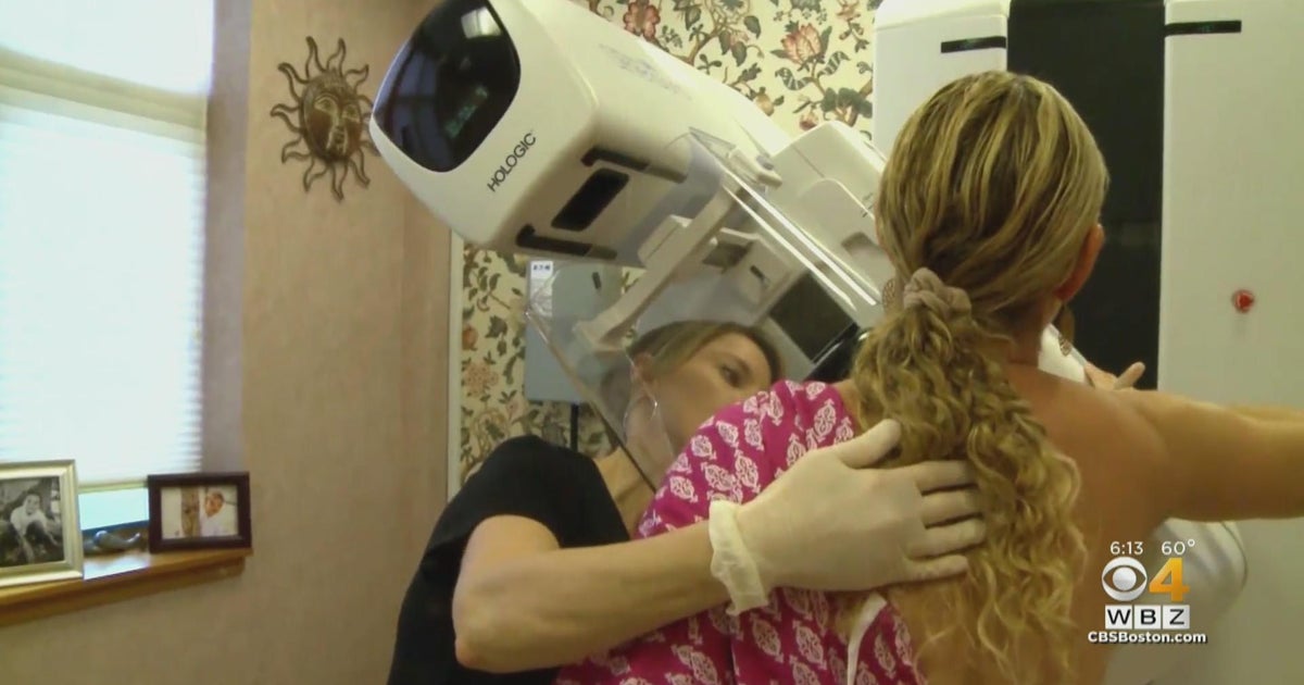 Breast cancer diagnoses increasing among young women - CBS Boston