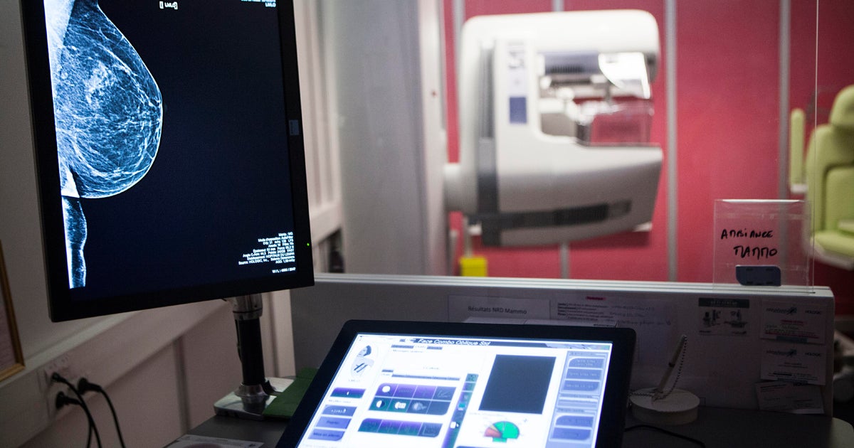 National Mammography Day serves as important reminder this Breast ...