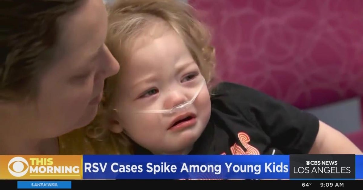 Rapid Surge Of Respiratory Illnesses Among Young Children Cbs Los Angeles