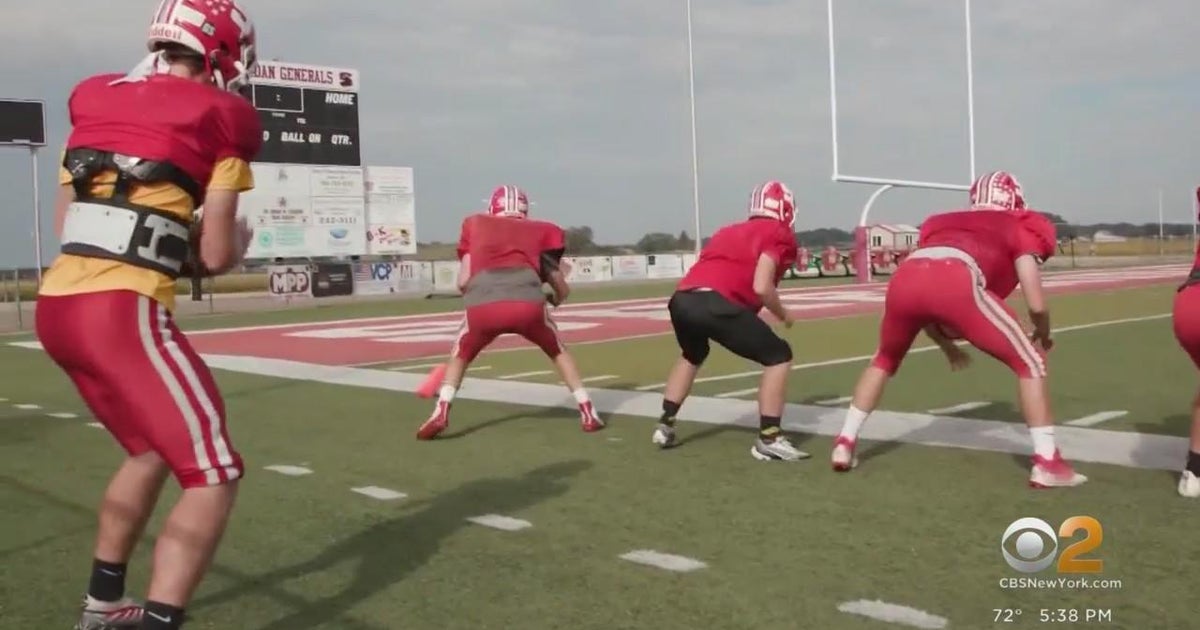 New research may help diagnose, manage concussions in children - CBS ...