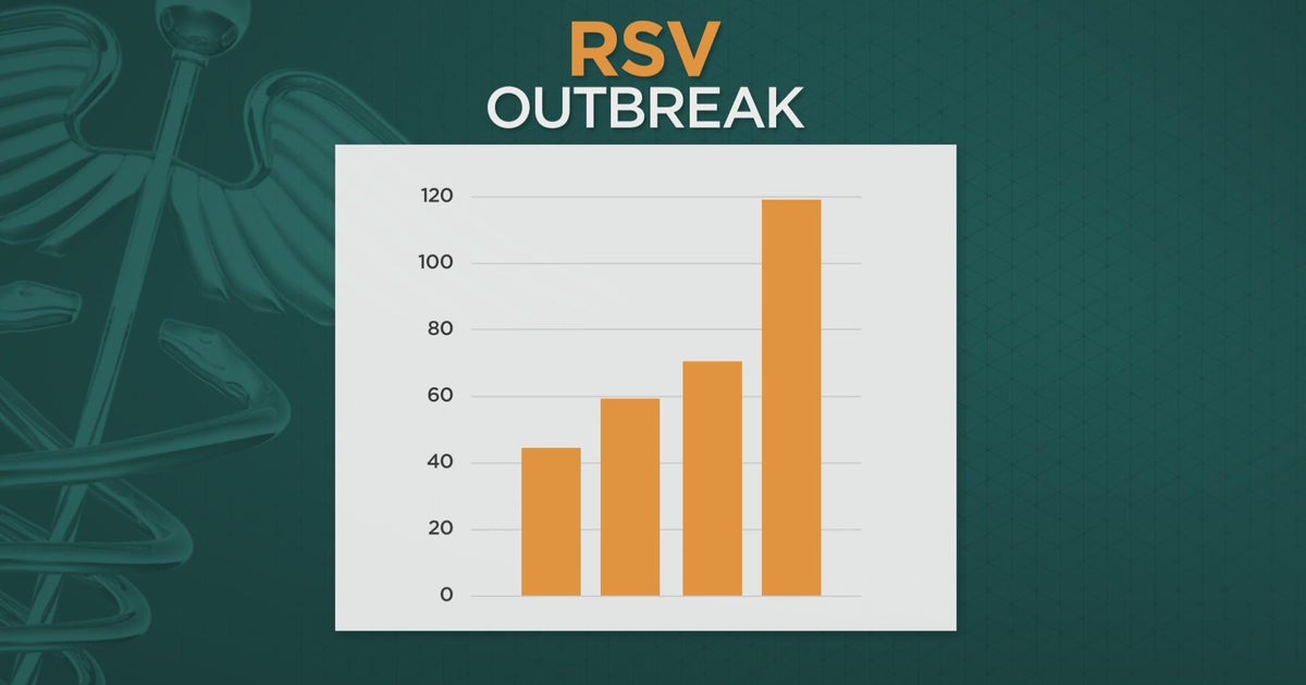 RSV outbreak putting stress on Minnesota hospitals - CBS Minnesota