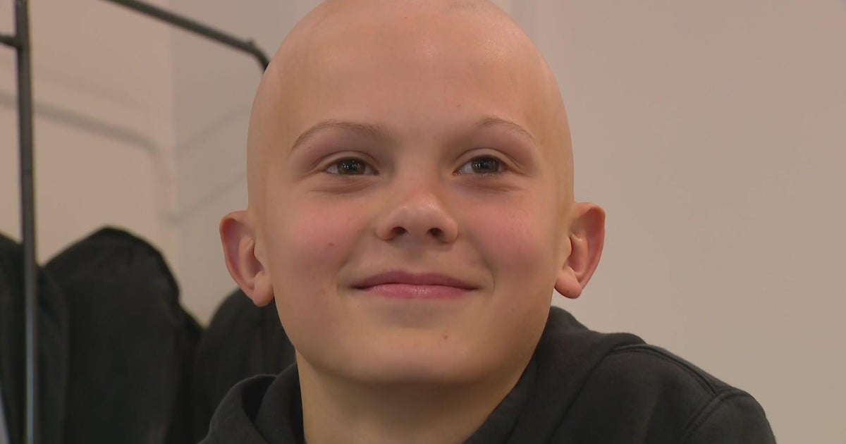 Middle schoolers shave head to support friend with alopecia - CBS Minnesota