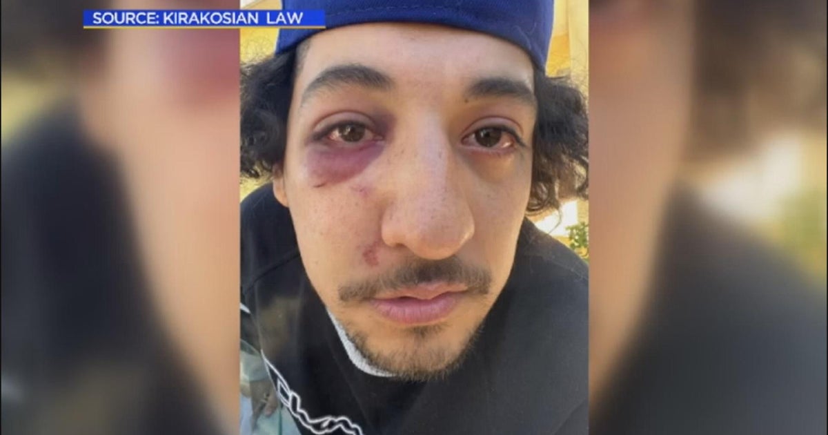 Man suing LA County for wrongfully detaining him after dangerous pursuit - CBS Los Angeles