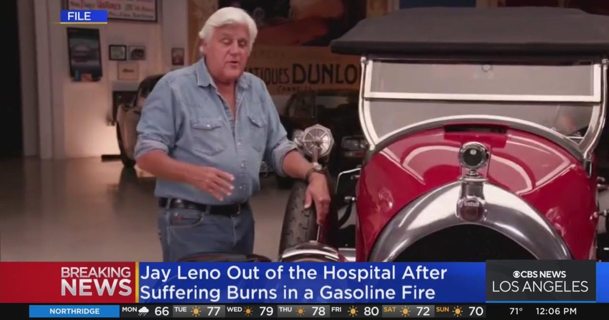 Jay Leno released from hospital after receiving treatment for burns - CBS Los Angeles