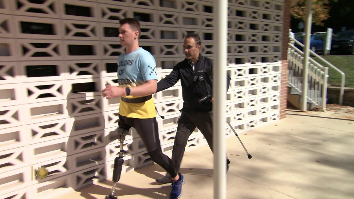 Helping a wounded Ukrainian soldier walk again - CBS News