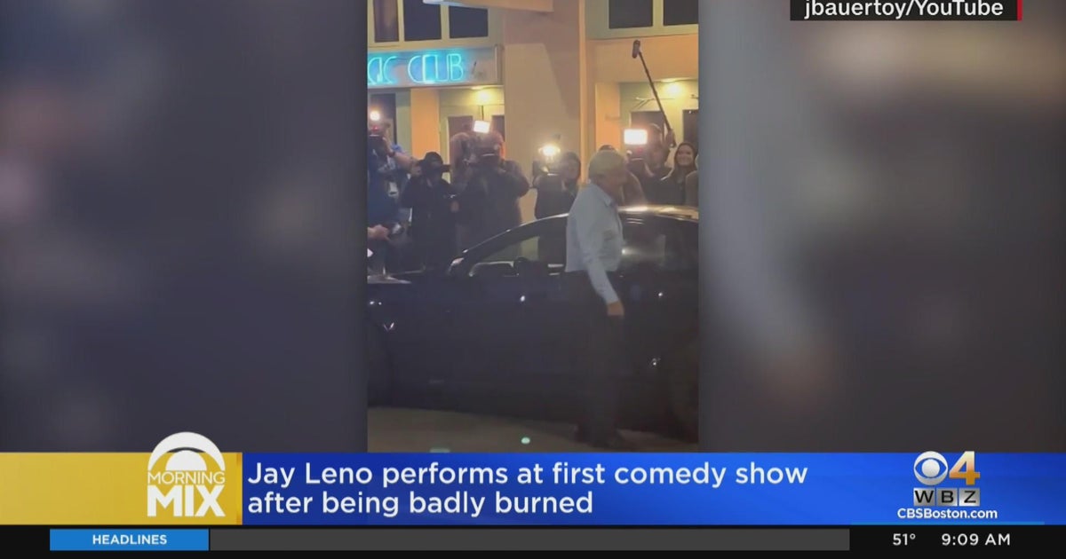 Jay Leno performs at California comedy club, 2 weeks after burn accident - CBS Boston