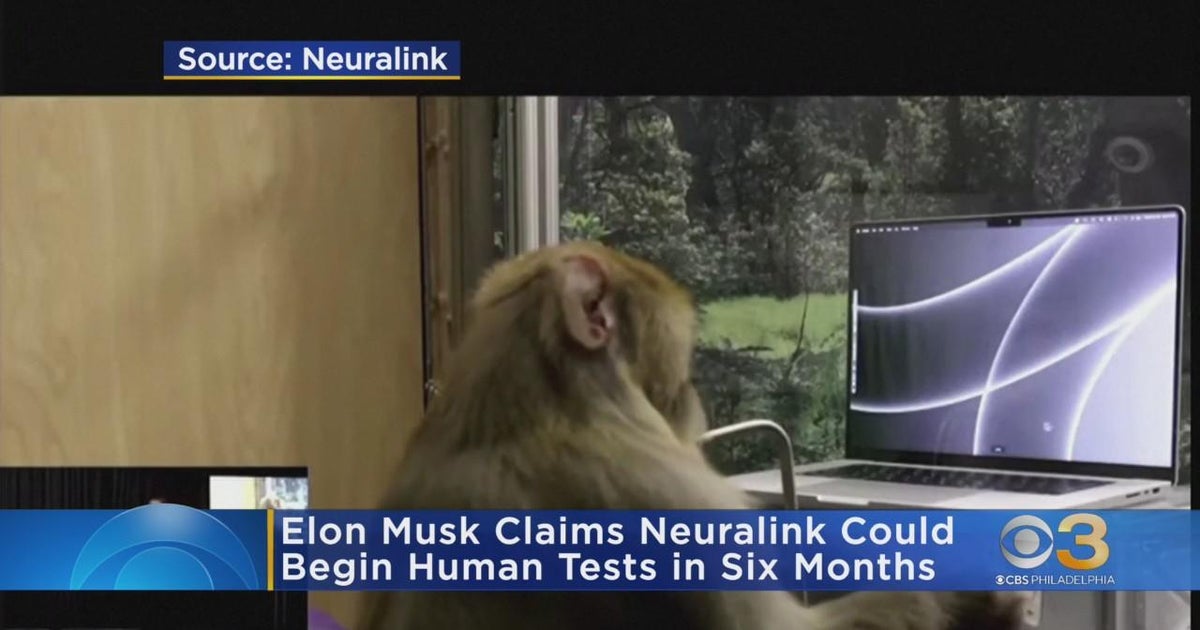 Elon Musk plans human tests for brain implant in 6 months - CBS ...