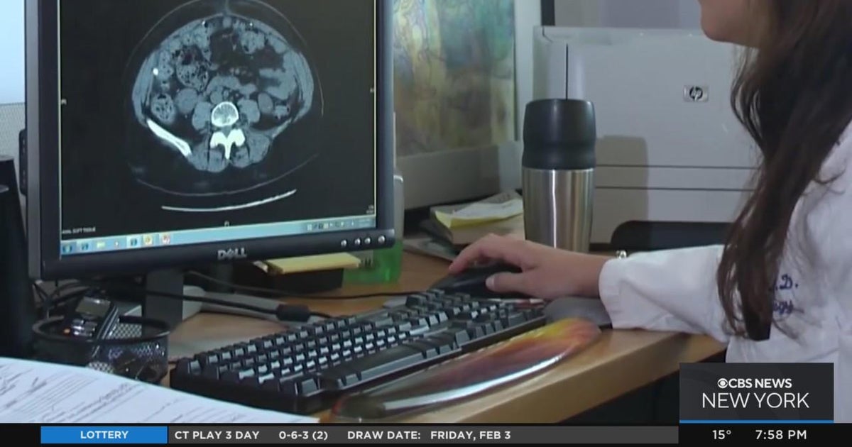 Doctors recommend fallopian tube removal to prevent ovarian cancer ...