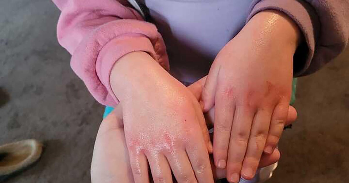 As reports of health problems near a toxic train wreck pile up, Ohio ...