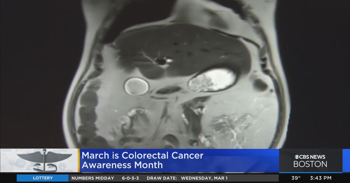 March is Colorectal Cancer Awareness Month - CBS Boston