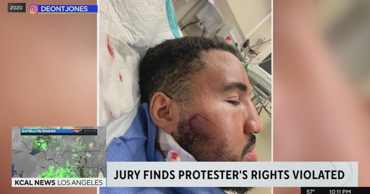 Los Angeles man awarded $375,000 in lawsuit over injury suffered during ...