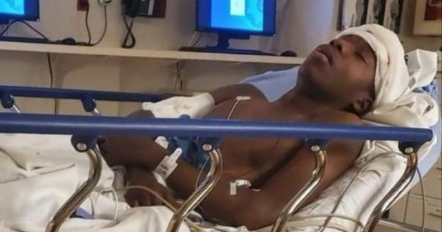 Homeowner Charged In Kansas City Shooting Of Black Teen Ralph Yarl