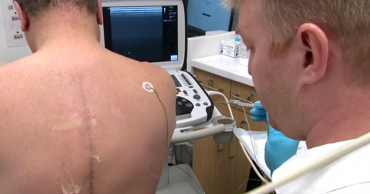 FDNY firefighter injured on 9/11 shares scar dancing syndrome diagnosis ...