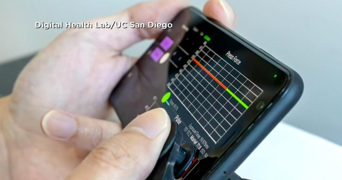 Smartphone attachment brings blood pressure monitoring to your ...