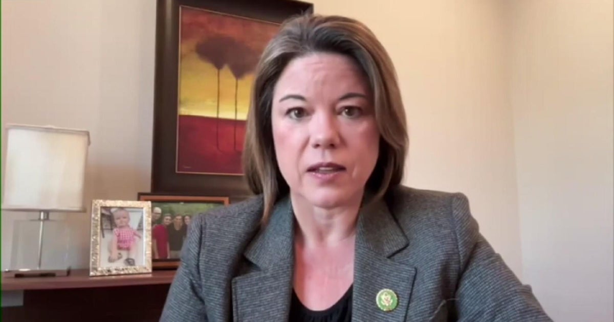 Rep. Angie Craig needs ankle surgery - CBS Minnesota