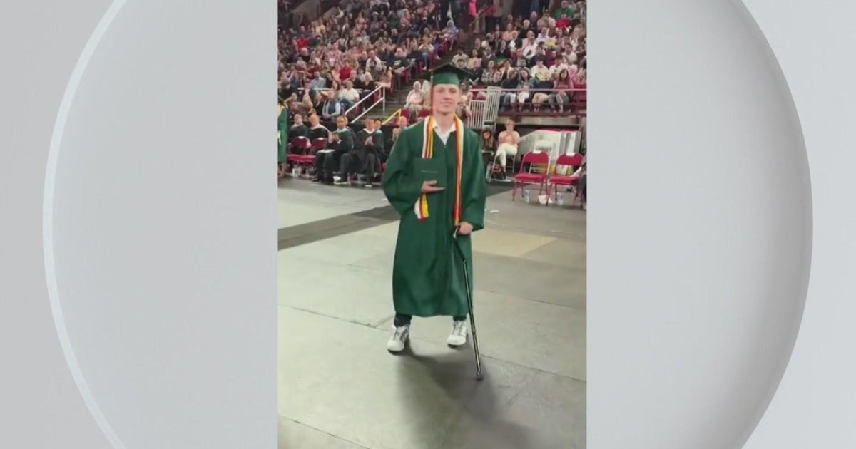 Paralyzed teen walks again but won't stop there - CBS Colorado