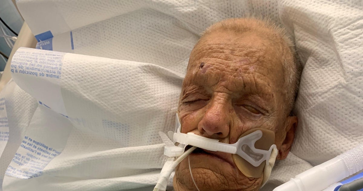 Santa Monica hospital asking for help identifying unconscious patient ...