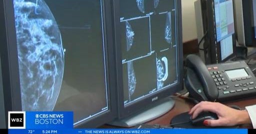 Dana-Farber doctor explains change to breast cancer screening ...