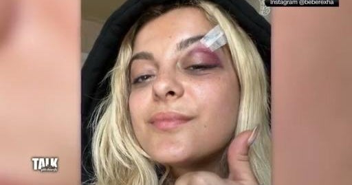 Singer Bebe Rexha goes to hospital after someone throws phone on stage ...