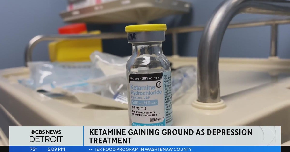 Ketamine treatment for depression gaining popularity in US - CBS Detroit