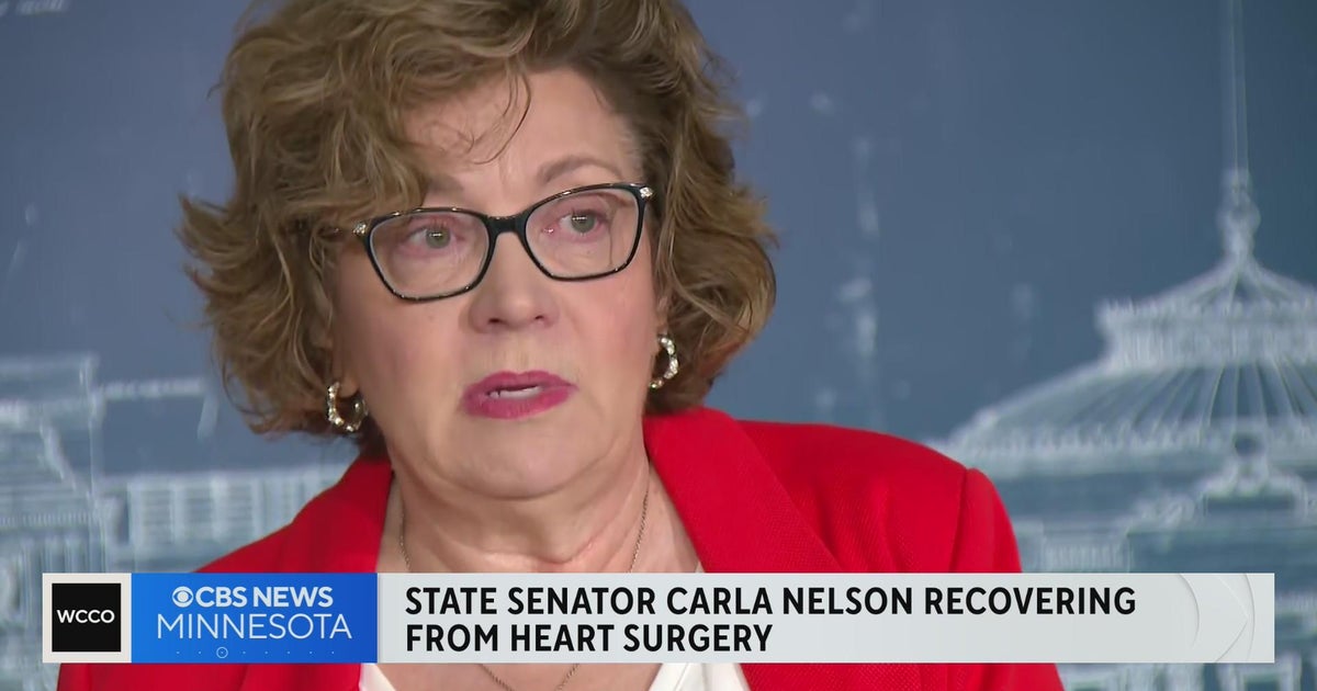 Sen. Carla Nelson recovering from heart surgery - CBS Minnesota