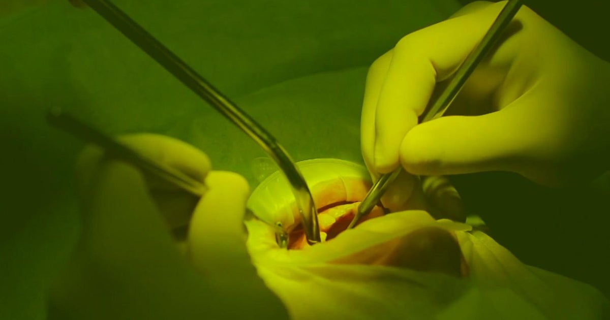 Call Kurtis: Where's my dental refund? - CBS Sacramento