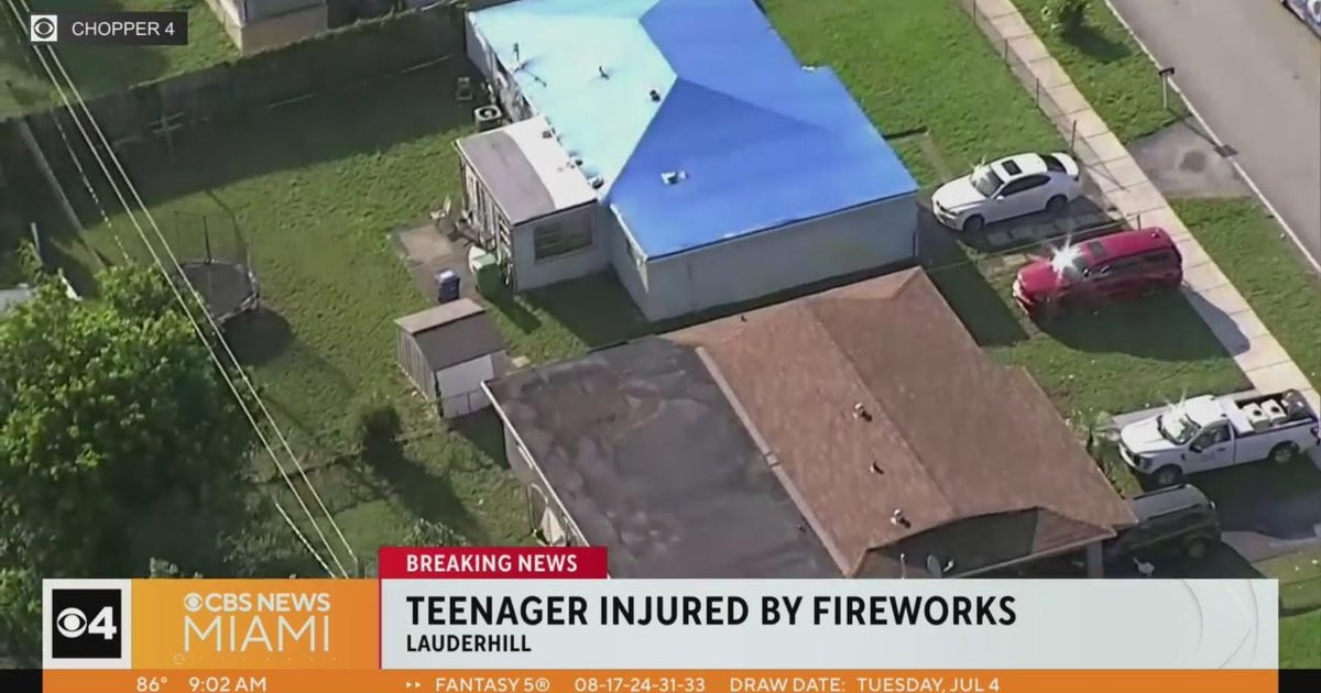Teen's fingers partially amputated in Lauderhill fireworks accident ...
