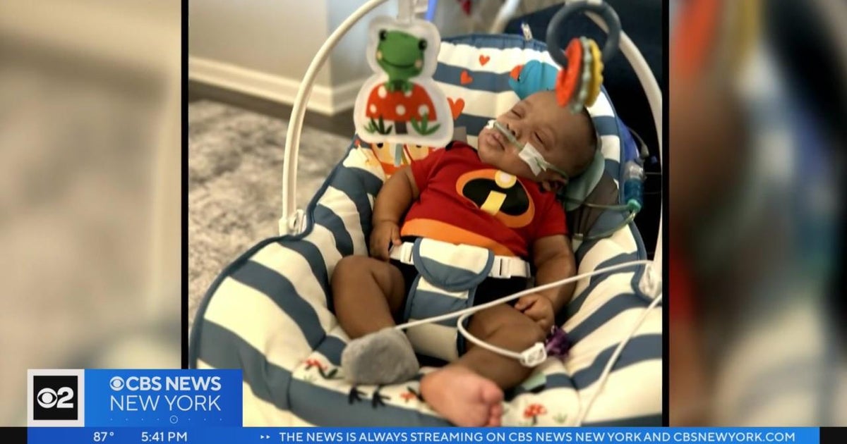 Baby in Pennsylvania receives smallest pacemaker in the world - CBS New ...