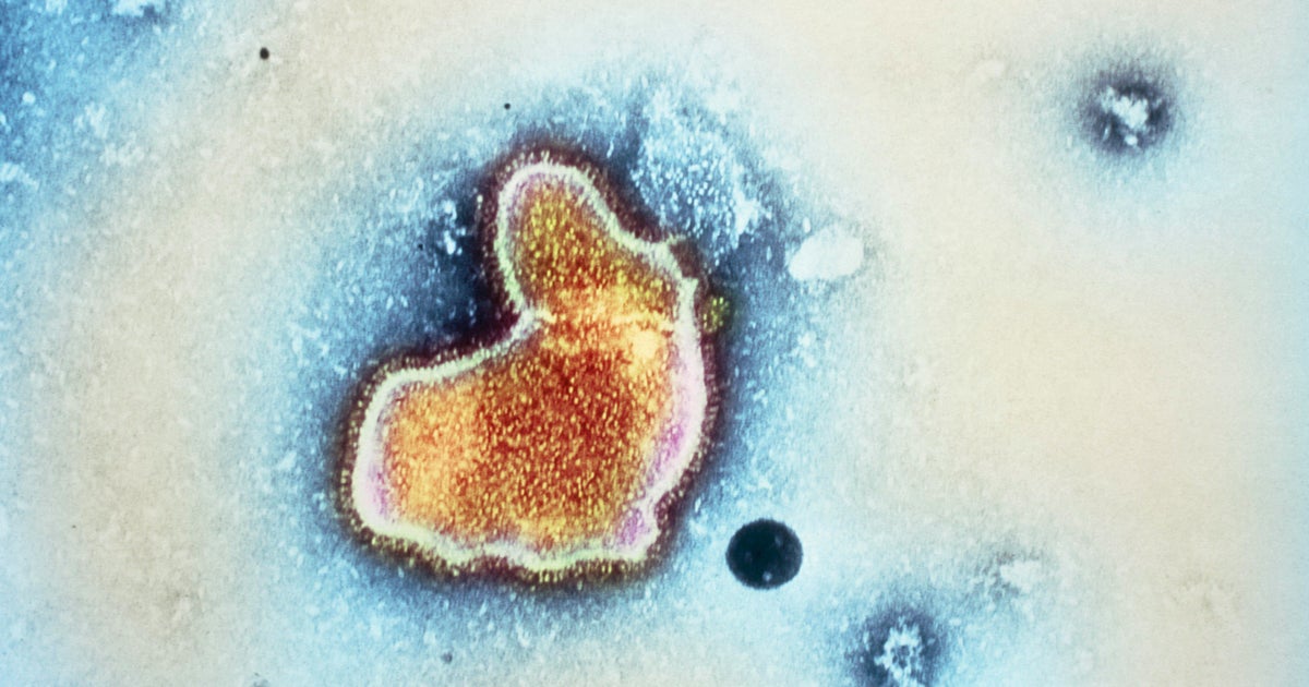 FDA approves antibody to protect infants from RSV - CBS Sacramento