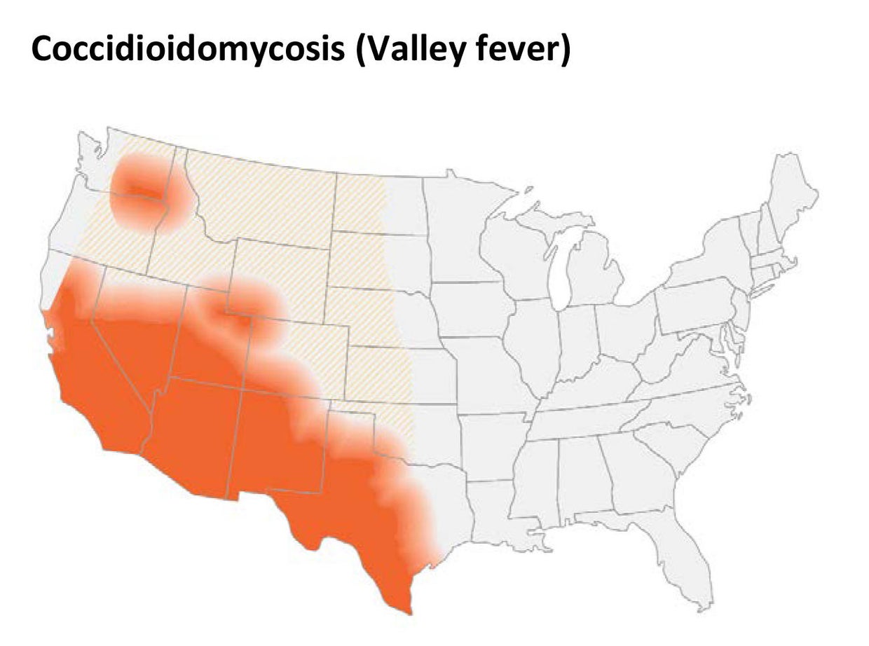 Valley fever is on the rise in the U.S., and climate change could be ...