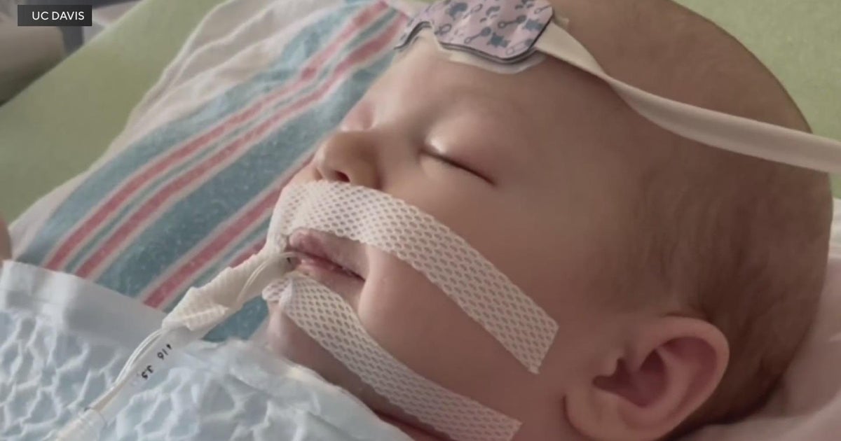 Sacramento infant's RSV diagnosis leads to discovery of rare heart ...