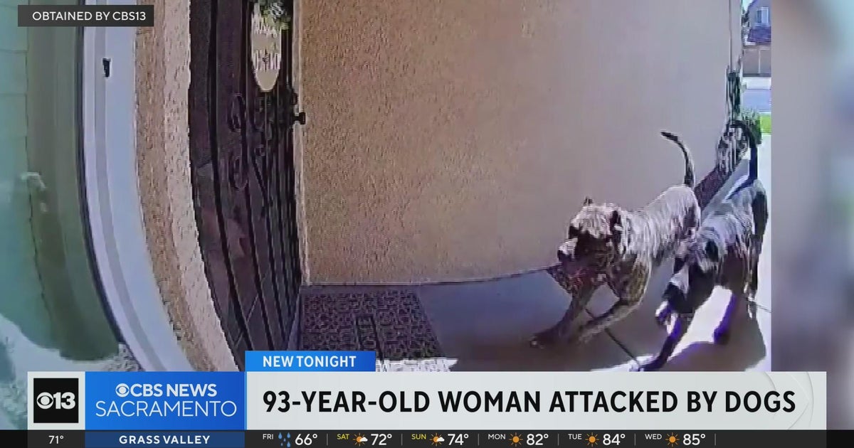 Modesto woman hospitalized after being attacked by neighbor's dogs ...
