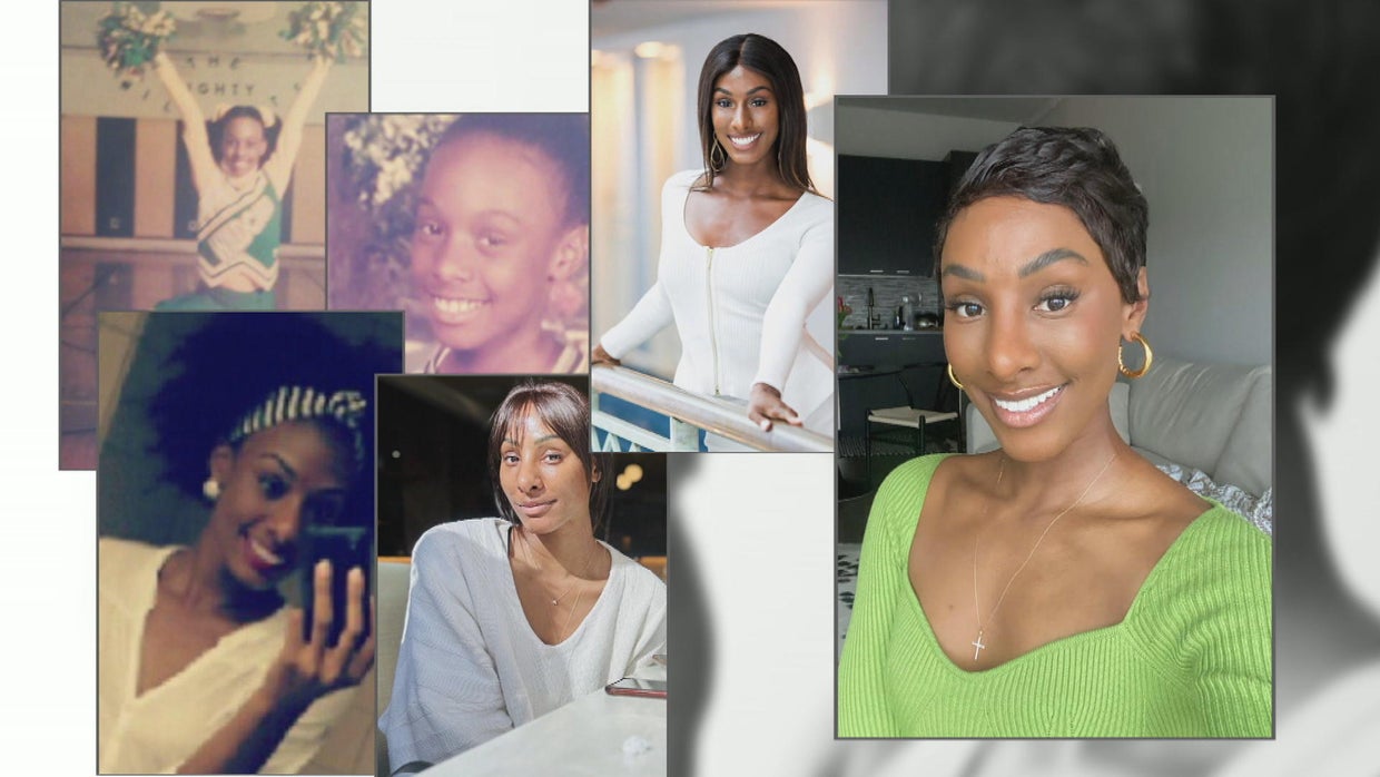 Showing my true self to the world with alopecia: "I wanted to be free ...