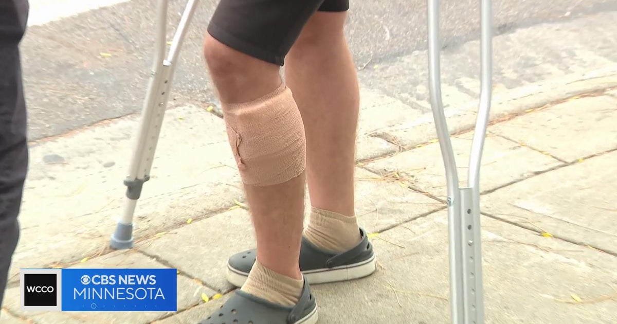 LynLake shooting leaves man with bullet stuck in his leg - CBS Minnesota