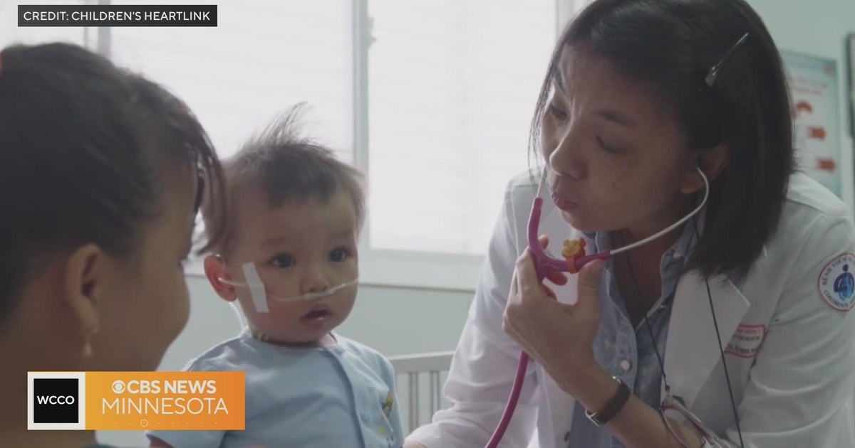 How Children's Heartlink helps young heart patients worldwide - CBS ...