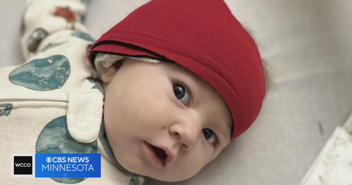 Newborn receives cochlear implant, among youngest ever to get one - CBS ...