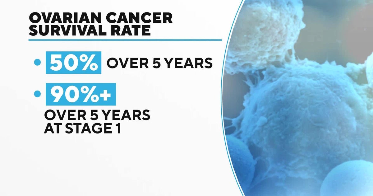 Many women mistakenly believe a paps smear can detect ovarian cancer ...