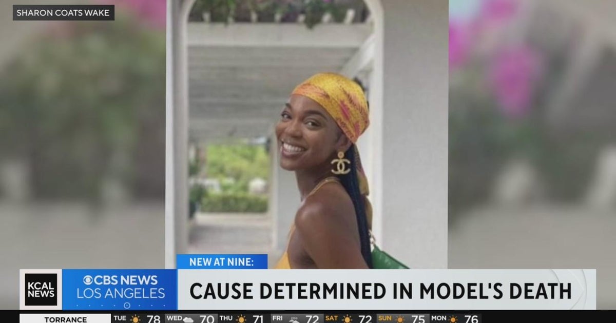 Medical Examiner classifies model's death as accidental - CBS Los Angeles