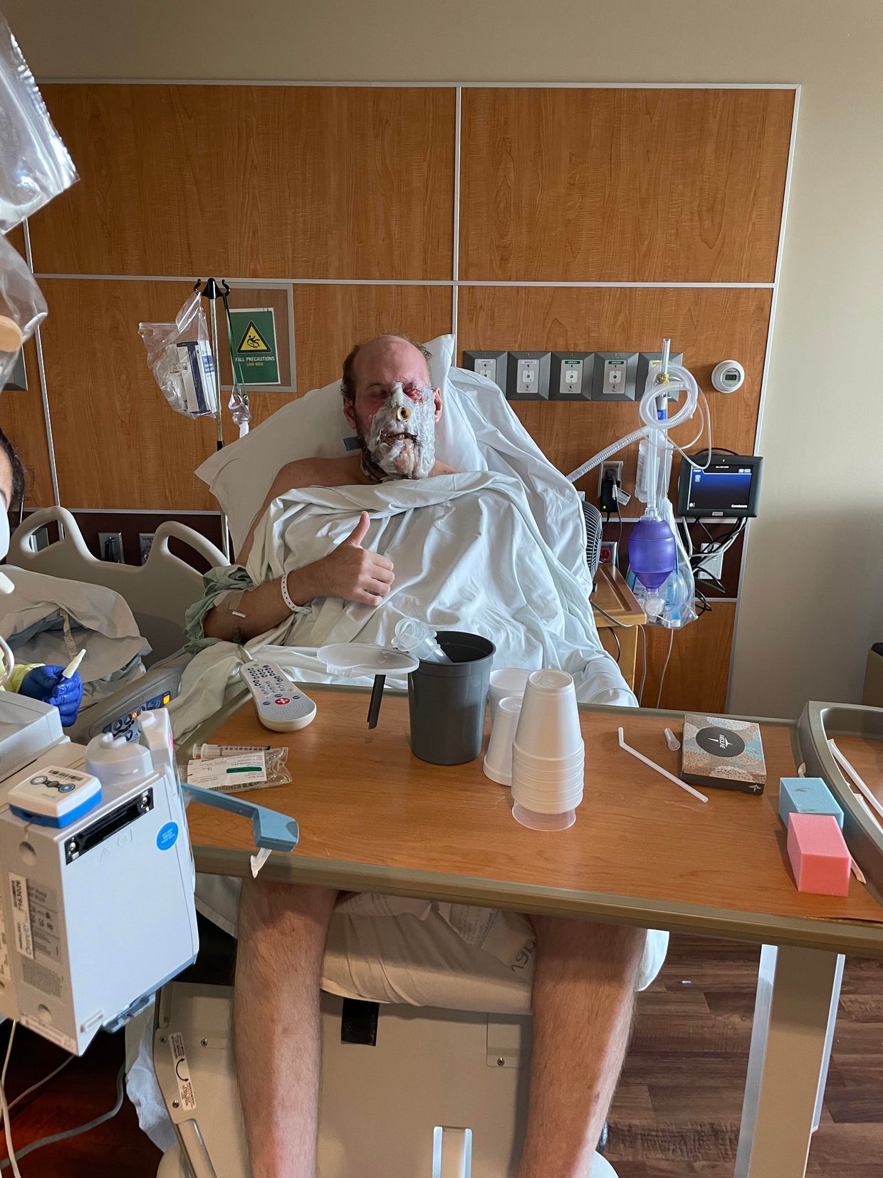 Man who narrowly survived electrical accident receives world's first ...