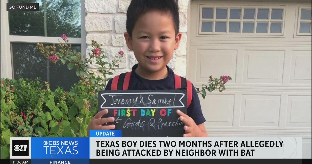 Texas boy dies 2 months after being attacked by bat - CBS Texas