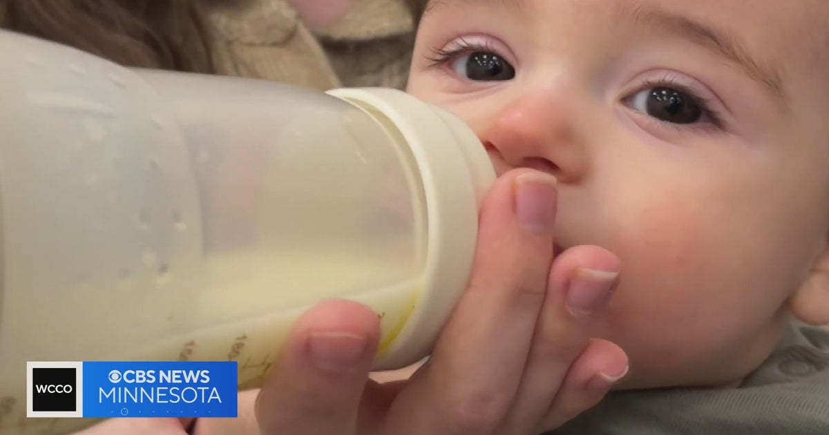Complicated surgery gives infant with rare condition new lease on life ...