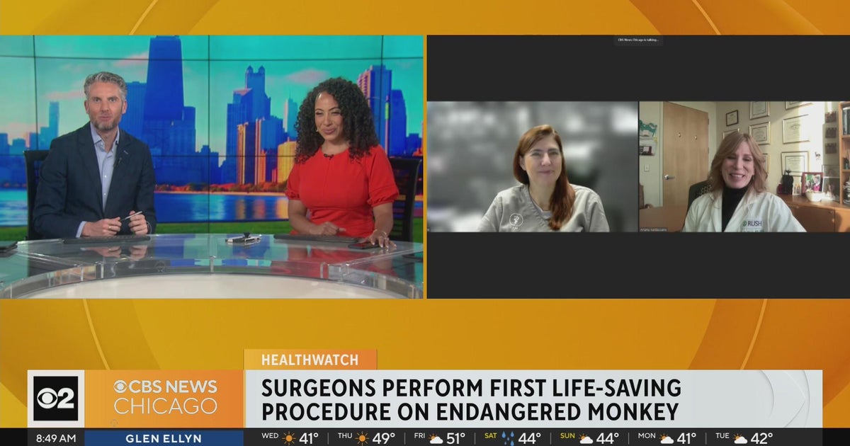 Surgeons perform first life-saving procedure on endangered monkey - CBS ...