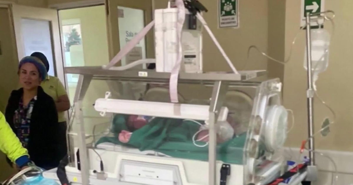 Baby weighing more than 15 pounds born in Chile - CBS Chicago