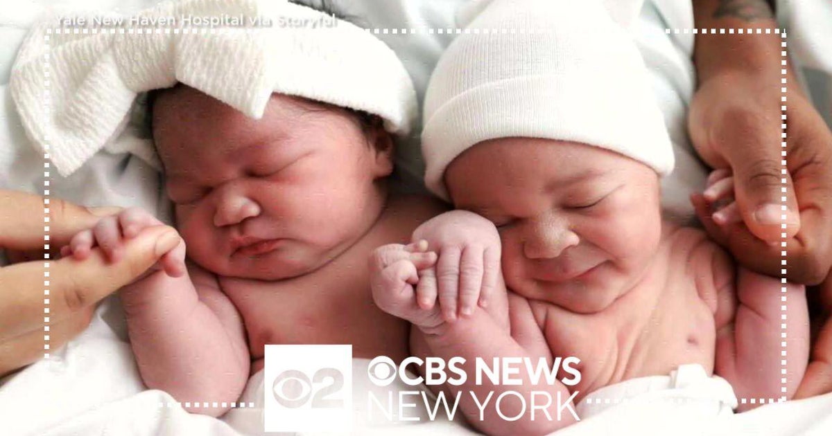 Twins in Connecticut born in different years - CBS New York
